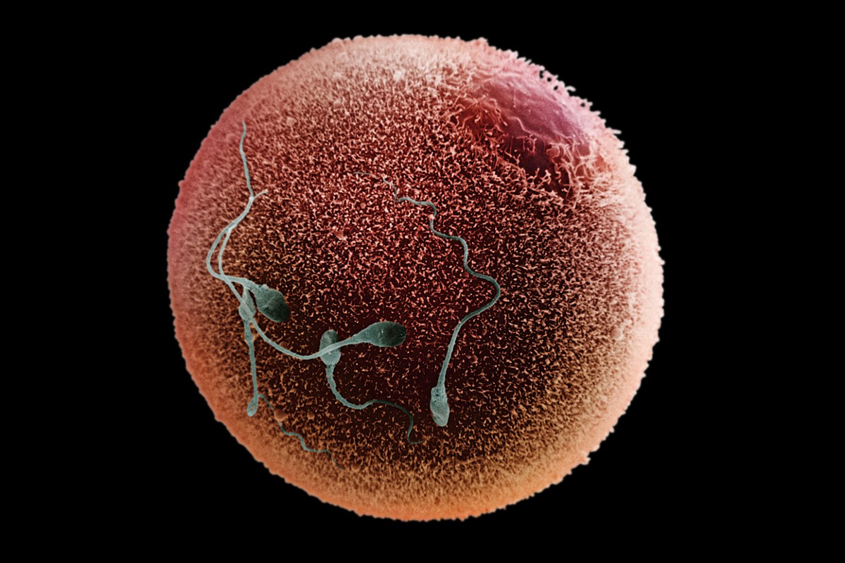 Sperm Cell And Egg Cell Fertilization