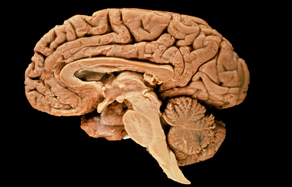 What Does A Human Brain Look Like - Infoupdate.org