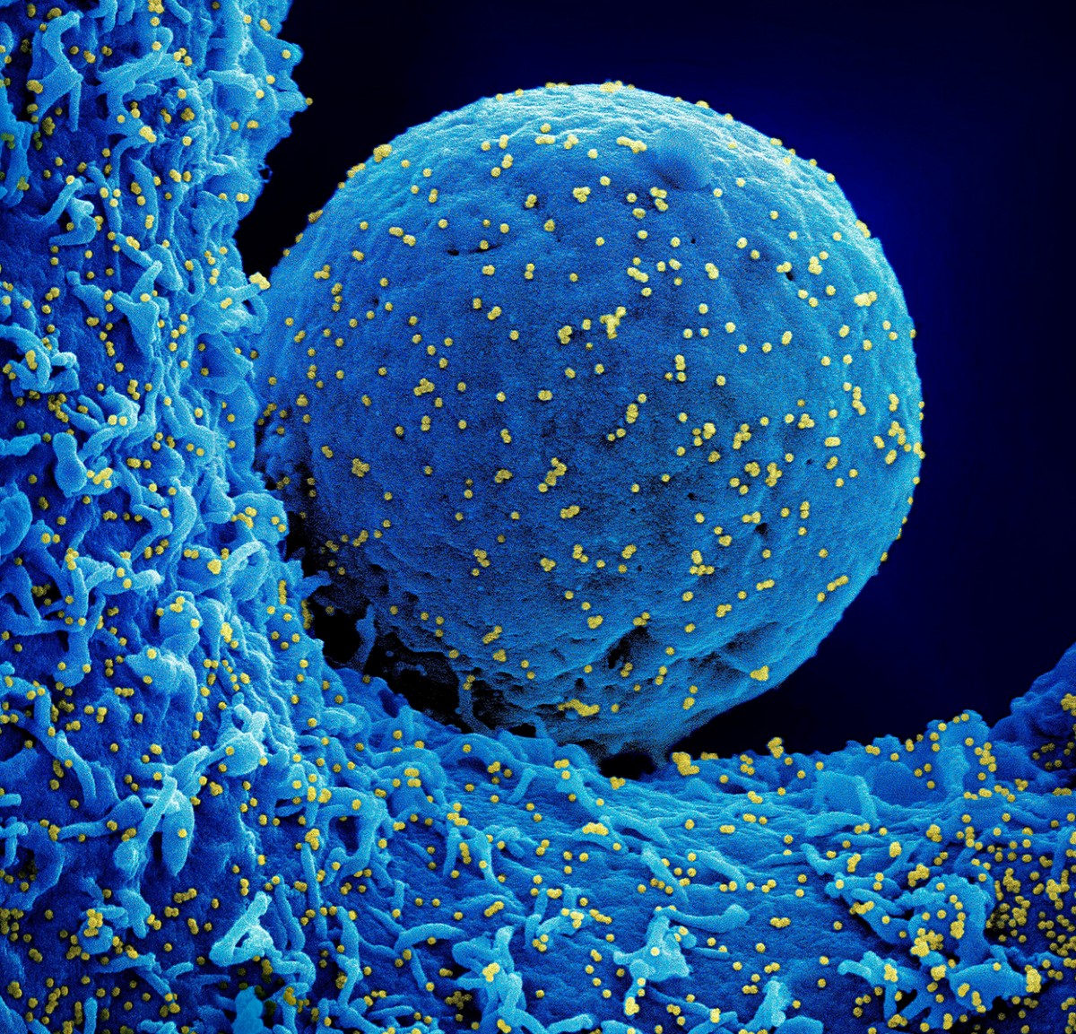What Do Germs Look Like In Real Life